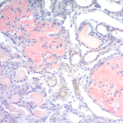 28009. CONGO RED STAIN KIT (AMYLOID STAIN) 100 TESTS ABCAM – CTR Scientific