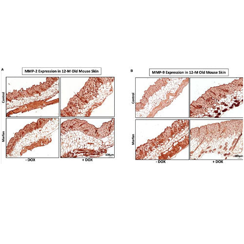27930. MOUSE AND RABBIT SPECIFIC HRP/DAB IHC DETECTION KIT-MICRO-POLYM ...