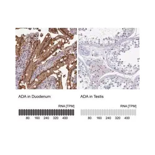 28824. ADENOSINE DEAMINASE/ADA ANTIBODY 0.1ML NOVUS BIOLOGICALS – CTR ...