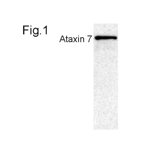 26475. ANTI-ATAXIN 7 ANTIBODY 50UG ABCAM – CTR Scientific