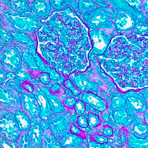 26406. PERIODIC ACID SCHIFF (PAS) STAIN KIT (MUCIN STAIN) 100 TESTS AB ...